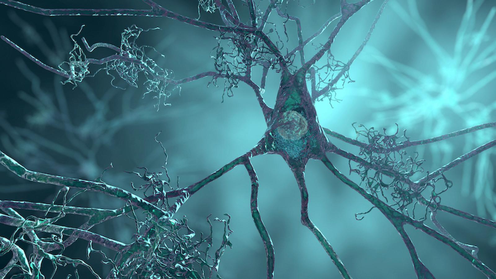 Other conditions | UK DRI